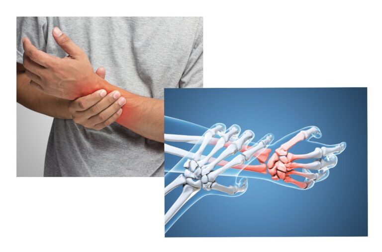 Elbow, Hand, and Wrist Pain Treatment - Halcyon