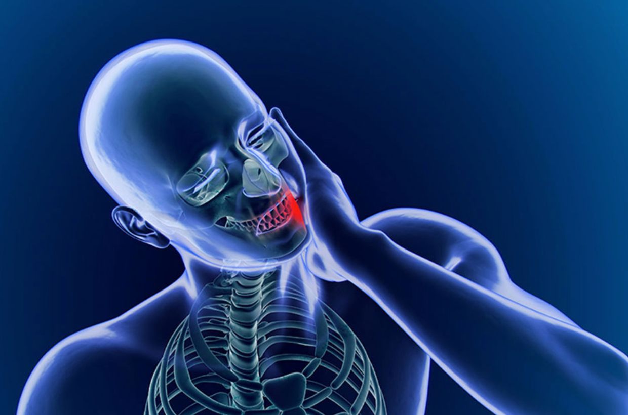 Trigeminal Neuralgia Treatment - Halcyon